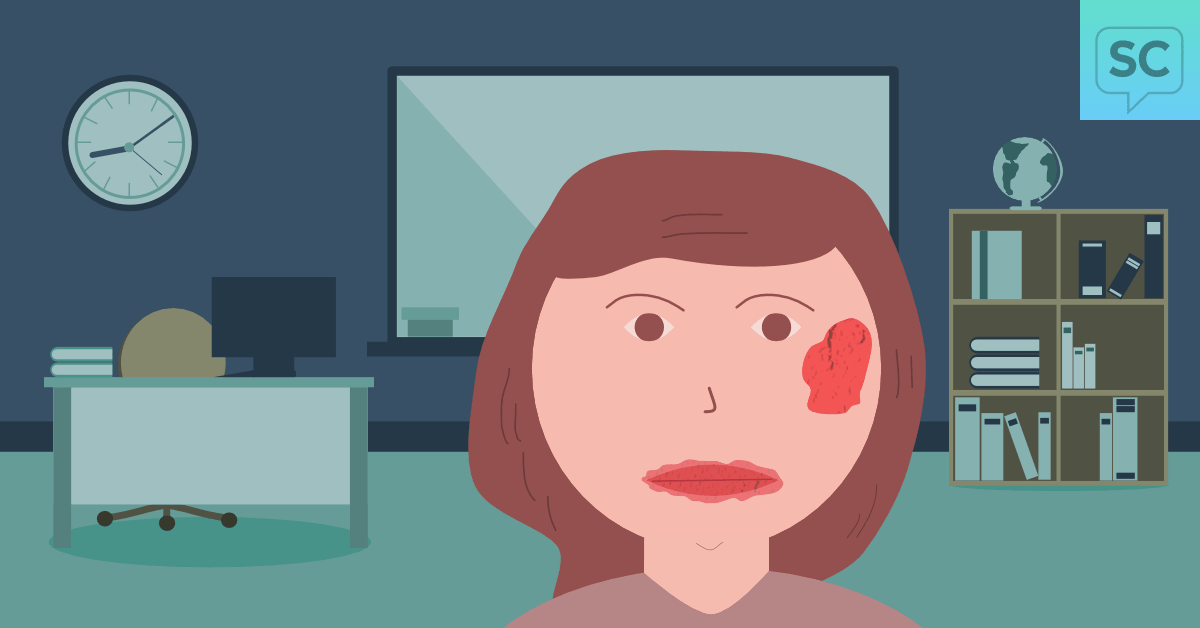 Using Efudex While Working: How to Cope with the Side Effects