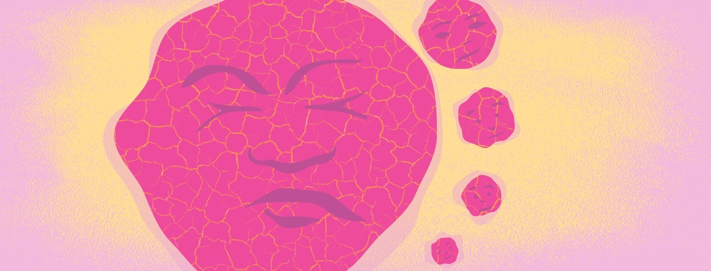 Spot Treatments: Easing into Efudex | SkinCancer.net