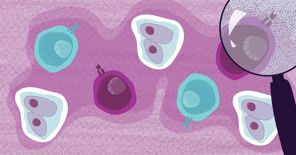 Basal Cell Carcinoma Vs Sebaceous Hyperplasia