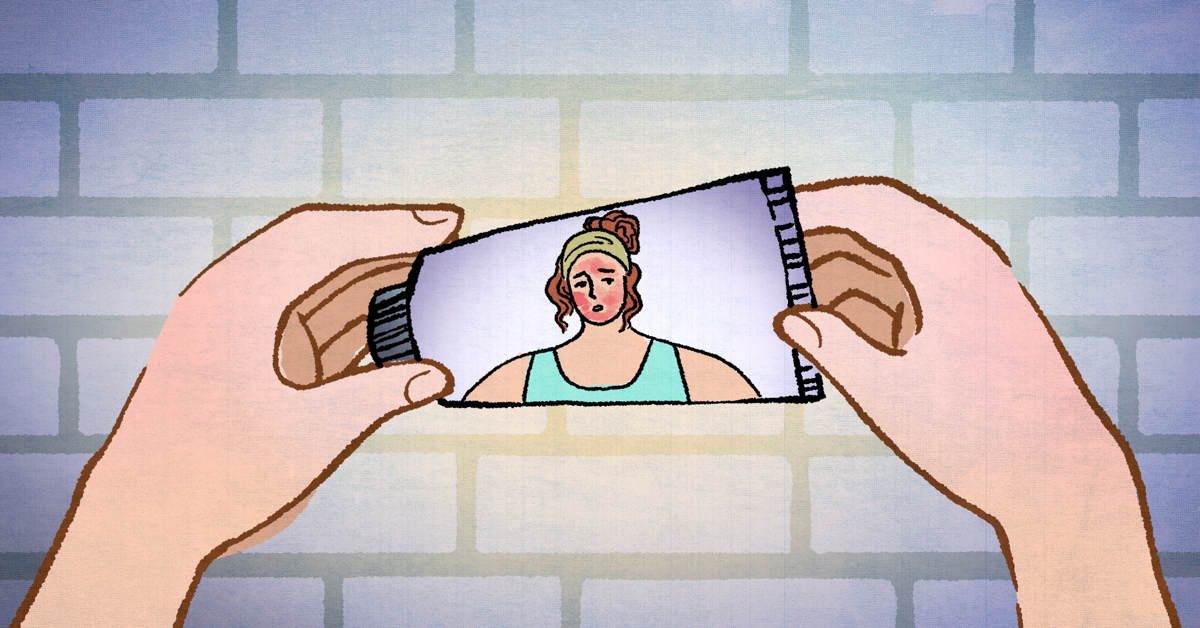 Healing after Efudex: Protecting Our New and Tender Skin